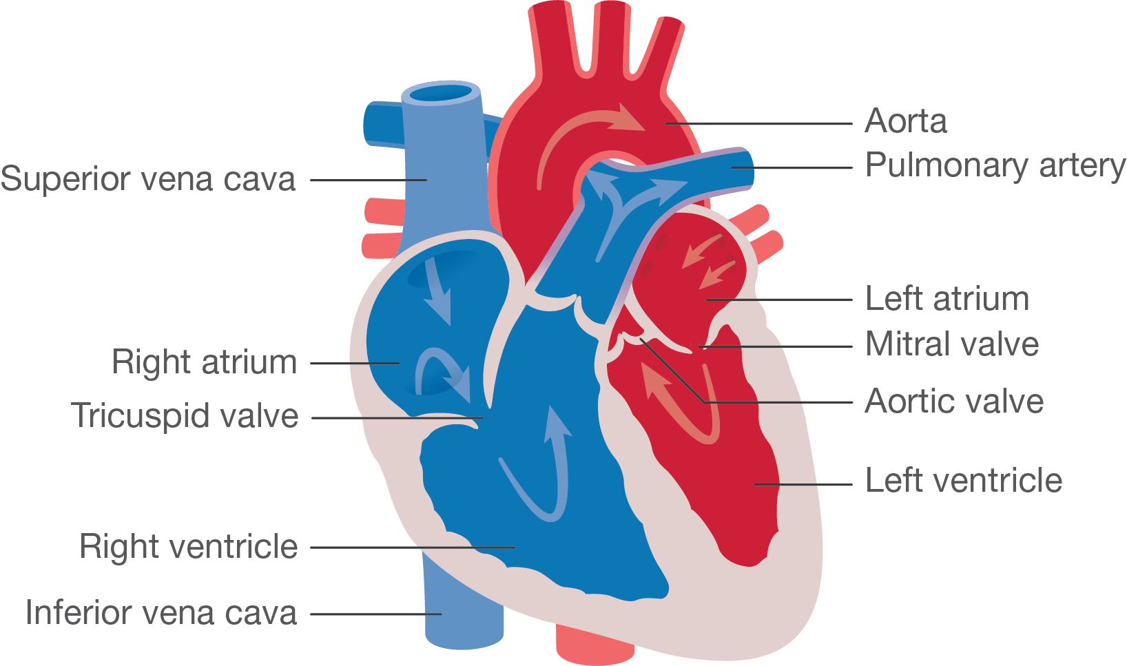 Pulmonary Atresia Pulmonary Atresia